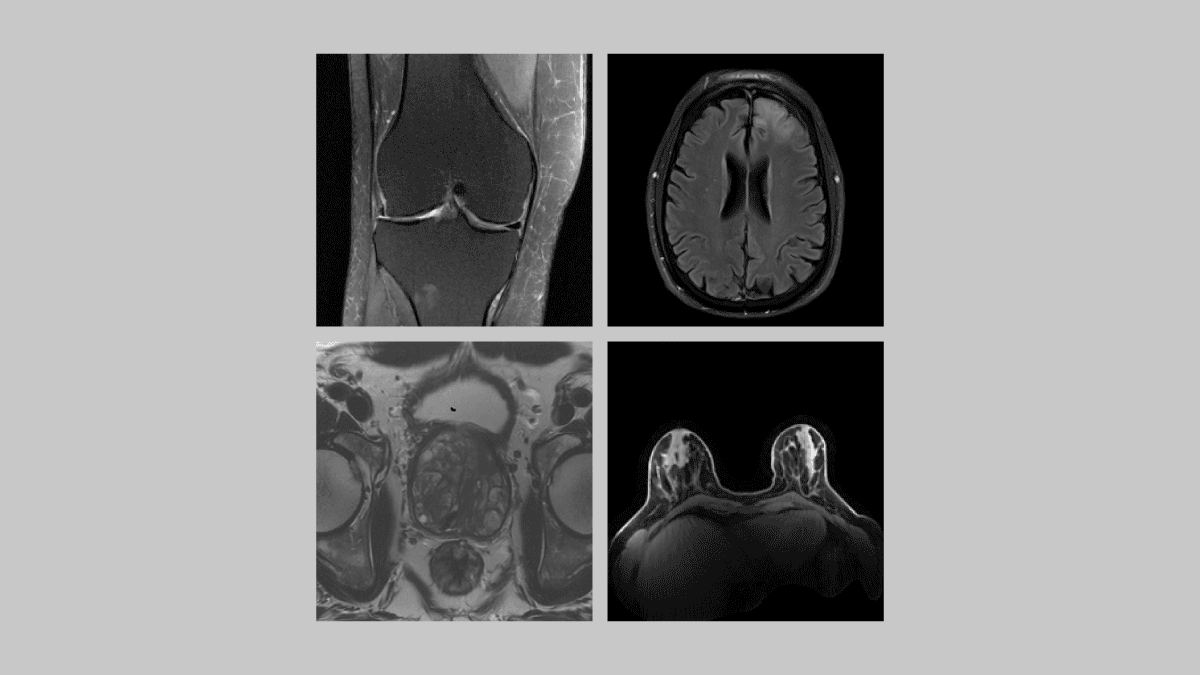 fastMRI Dataset • Center for Advanced Imaging Innovation and Research