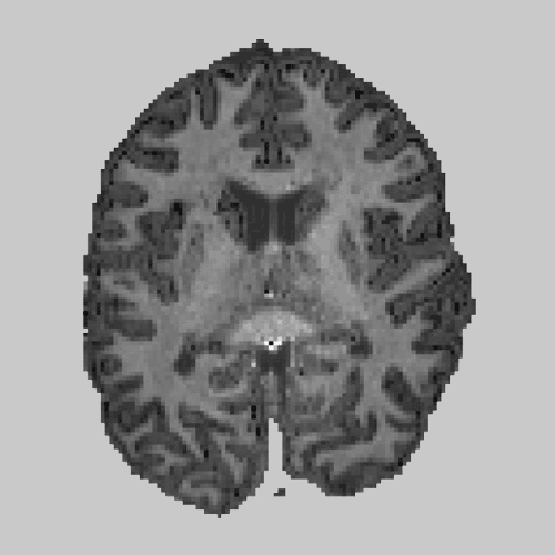 Diffusion Kurtosis Imaging MATLAB Toolbox • Center for Advanced Imaging ...