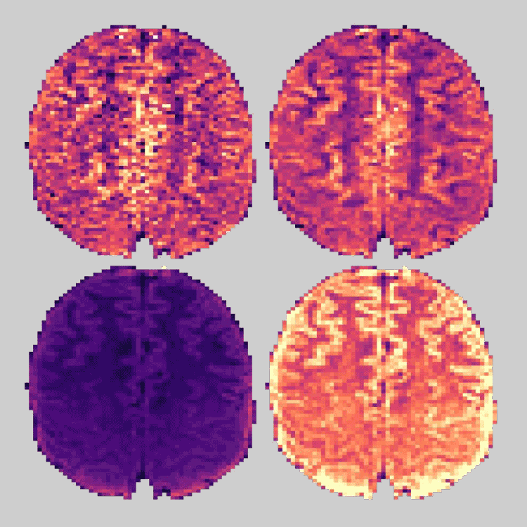 Denoising Using Marchenko-Pastur Principal Component Analysis • Center ...