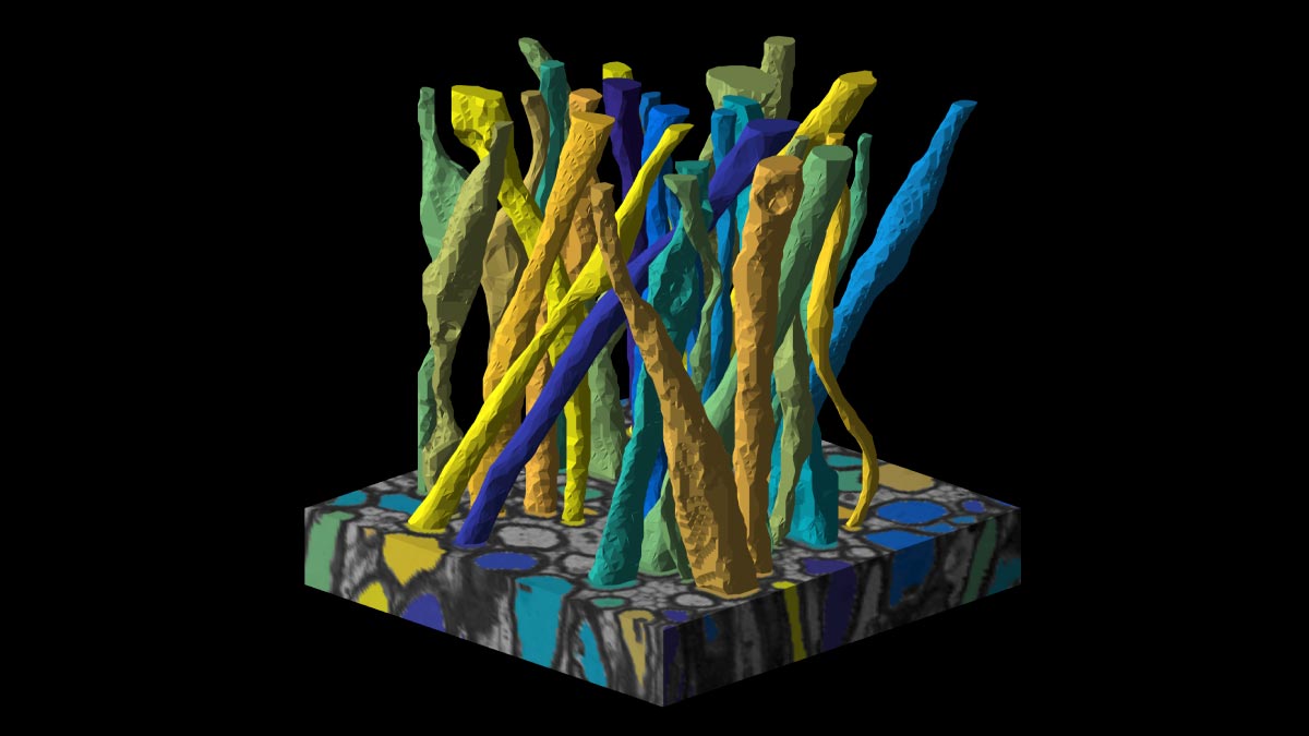 MRI Detects Variations in Diameters of Axons • Center for Advanced ...