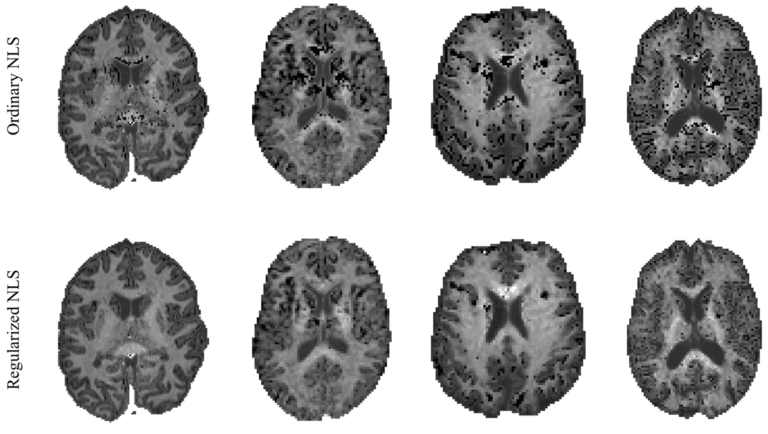 Diffusion Kurtosis Imaging MATLAB Toolbox • Center for Advanced Imaging ...
