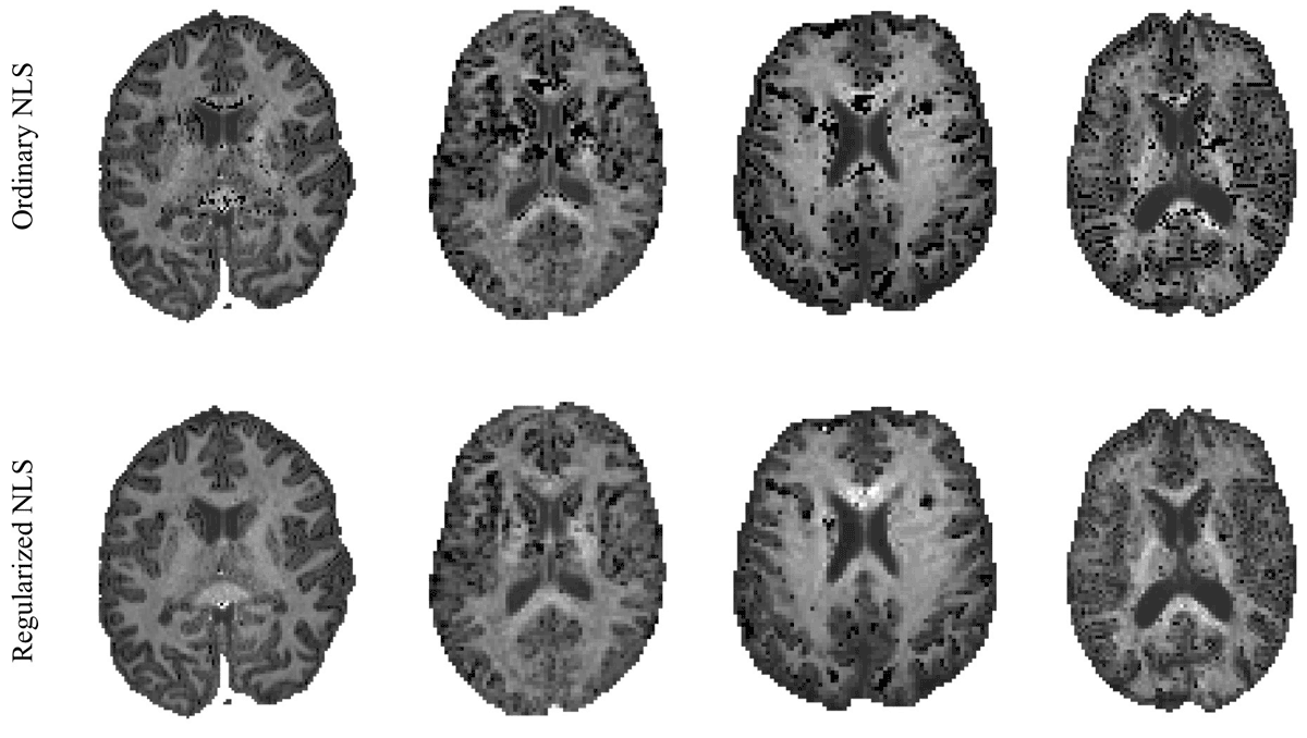 Diffusion Kurtosis Imaging MATLAB Toolbox • Center for Advanced Imaging ...
