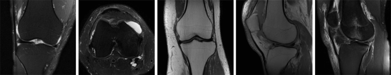 100 Knee MRI Cases • Center for Advanced Imaging Innovation and Research
