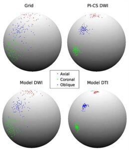 Model-based DTI Reconstruction with Variational Constraints • Center ...