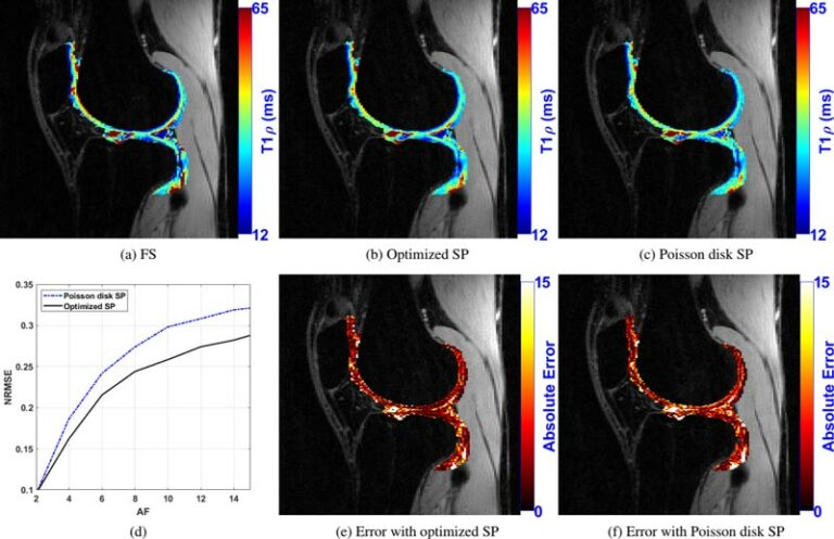 Data-Driven Learning of MRI Sampling Pattern • Center for Advanced Imaging Innovation and Research